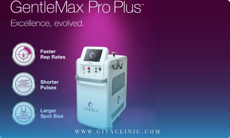 لیزر موهای زائد در ولنجک و زعفرانیه تهران | دستگاه کندلا